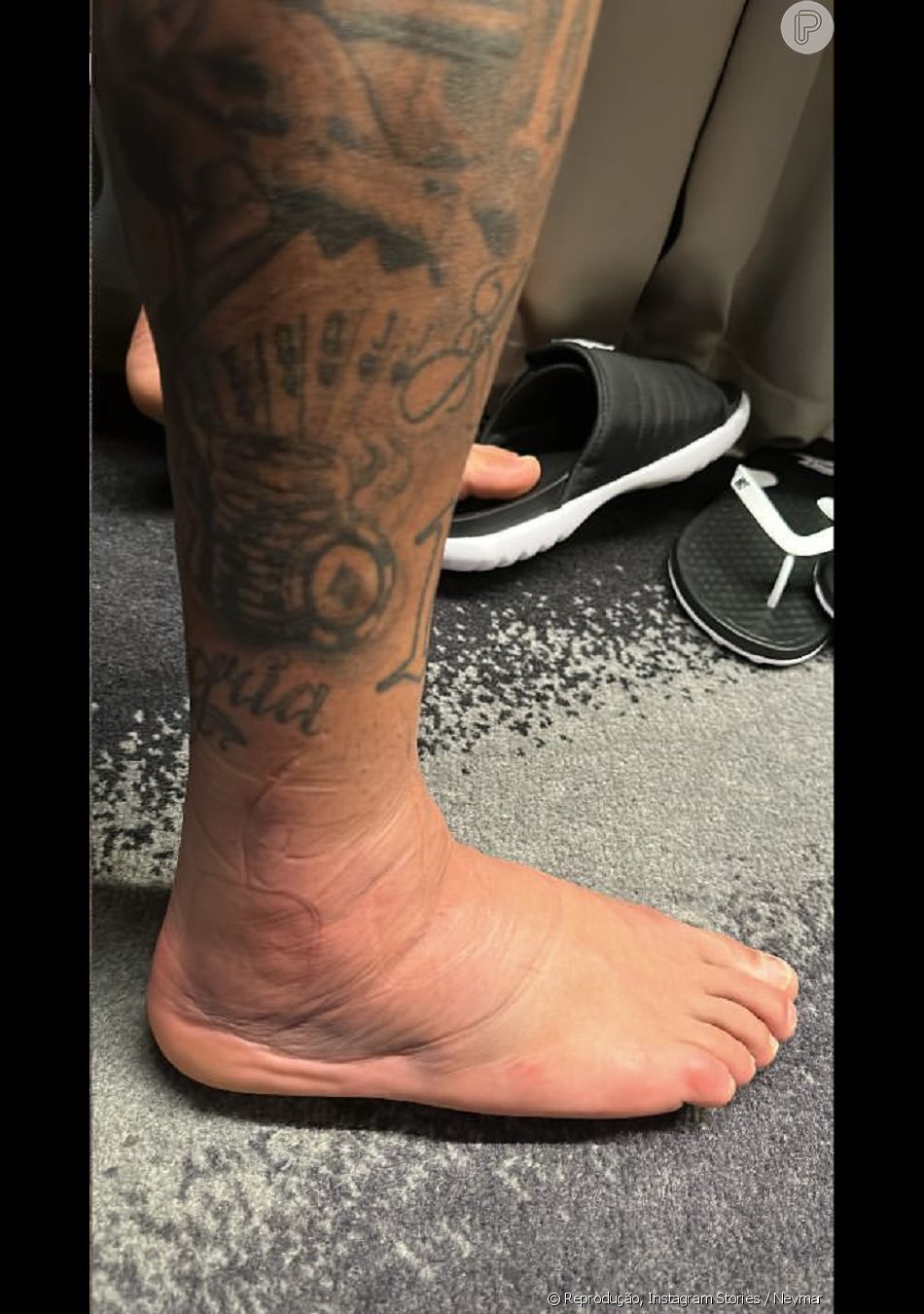 Copa do Mundo 22: Neymar Jr choca a web com foto do pé machucado: fotos ...
