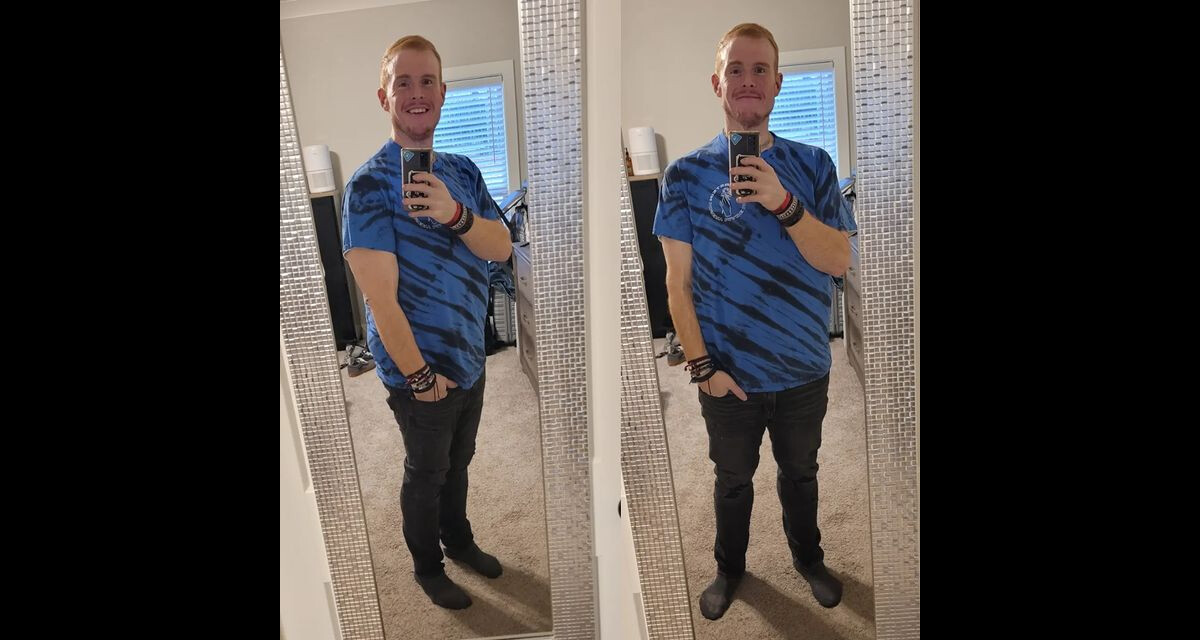 Foto: Fotos de antes e depois: Casey King compartilha em sua rede ...