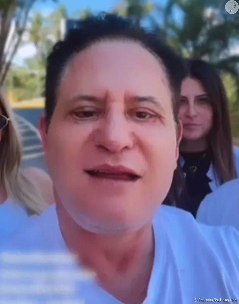 Marrone, da dupla com Bruno, mostra rosto após seis cirurgias e aprova ...