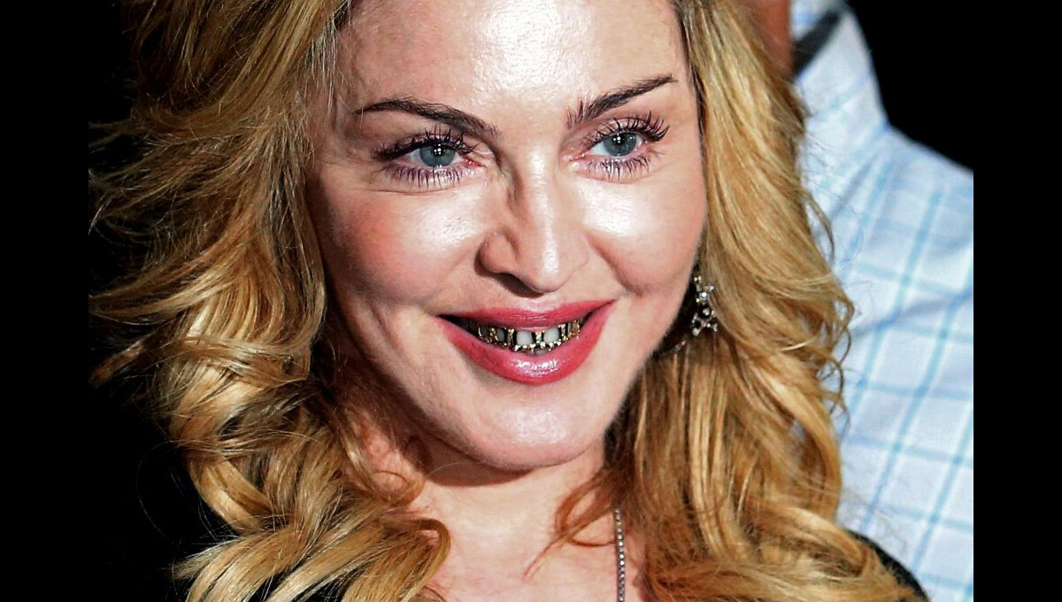 Foto: Madonna também já decorou seus dentes com o grillz - Purepeople