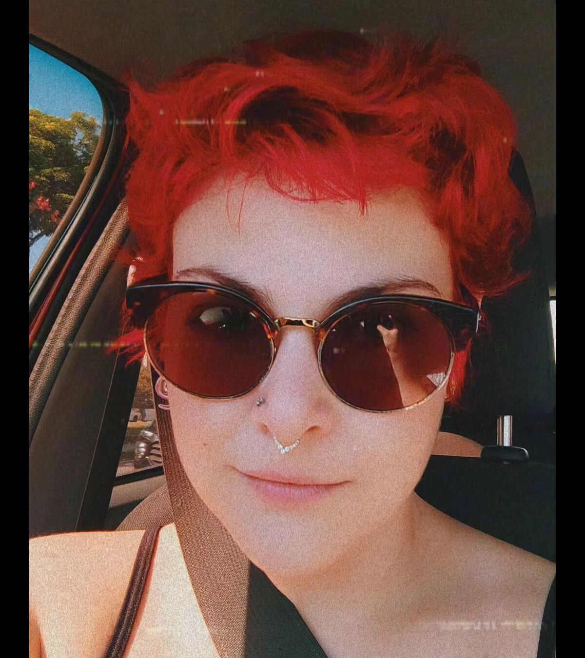 Foto: Raquel Fabbri precisou fazer uma vaquinha para pagar a operação ...