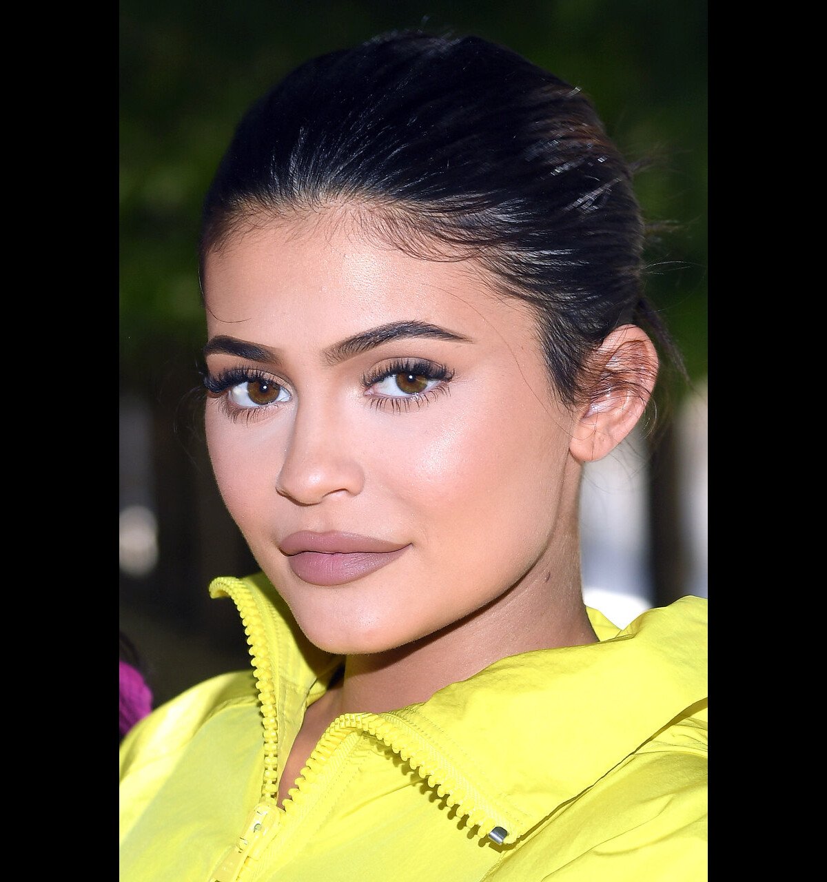 Foto: Kylie Jenner fez preenchimento por insegurança com lábios finos ...