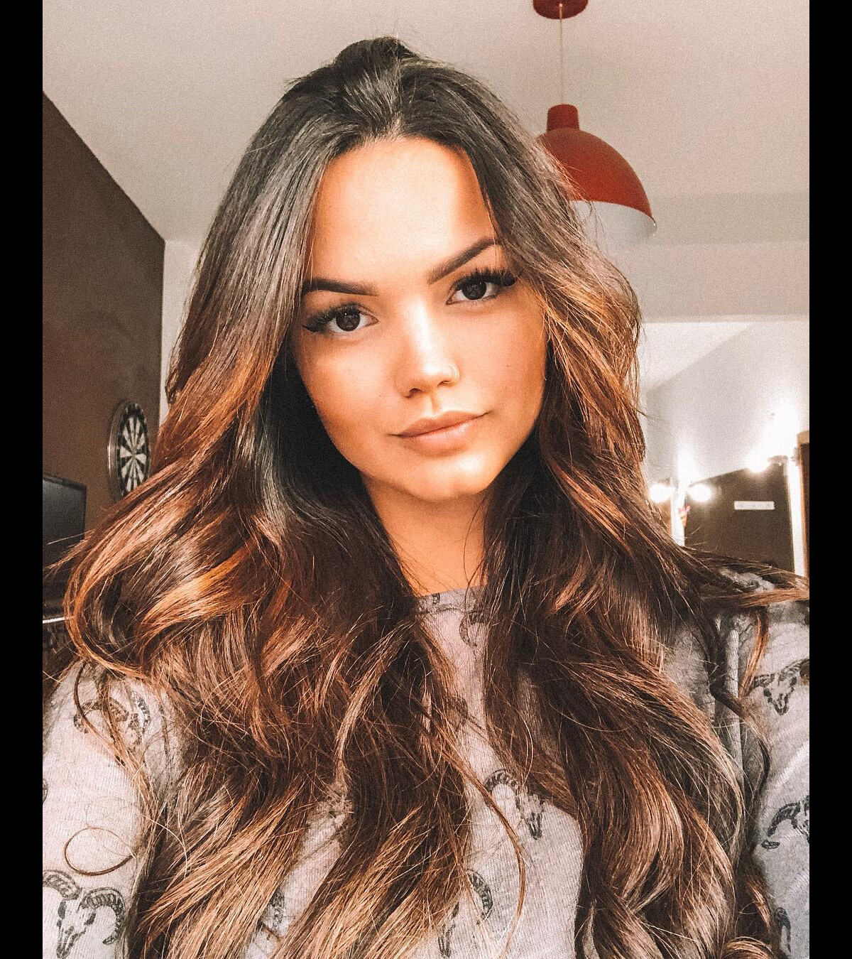 Foto: Filha de Kelly Key, Suzanna Freitas faz procedimento estético ...