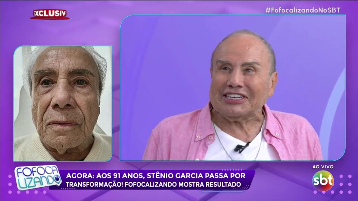 Foto: Stenio Garcia apareceu com o rosto inchado no SBT por conta da ...