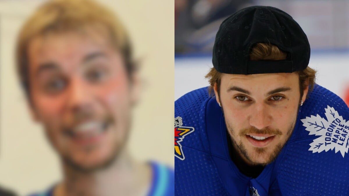 Foto: Justin Bieber está com os dentes podres? Foto viraliza na ...