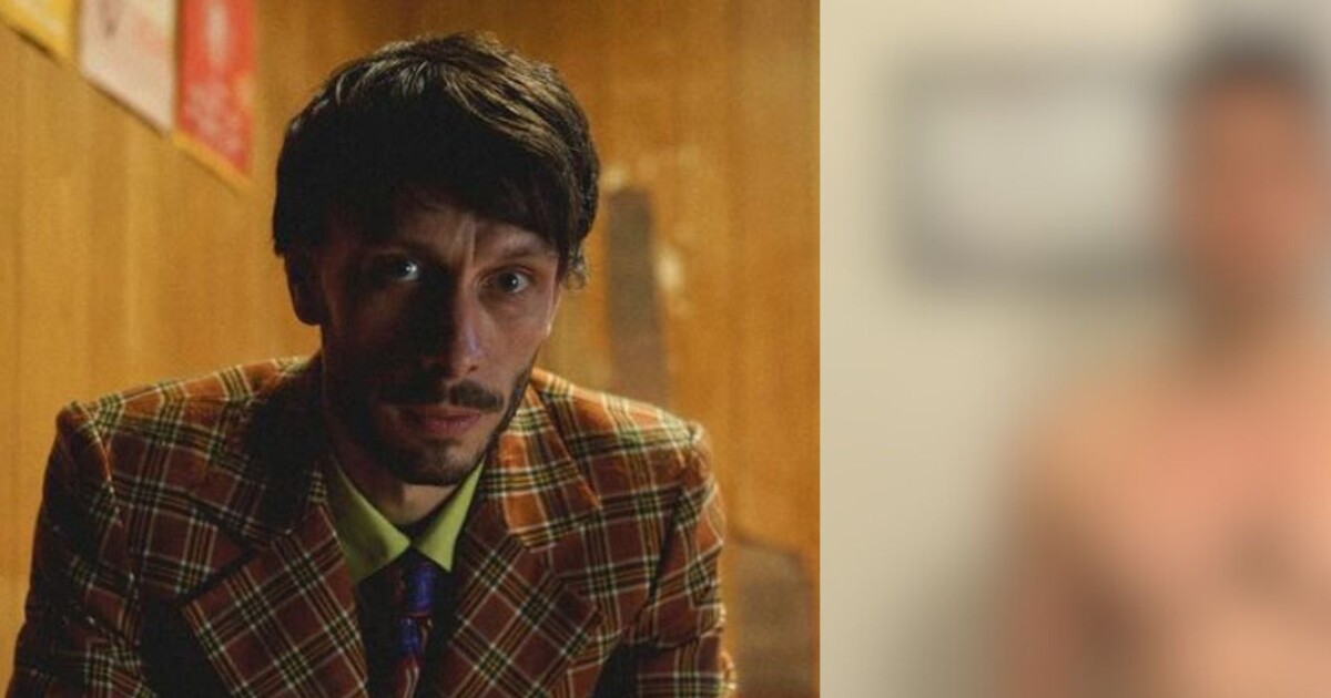 'Bebê Rena': Richard Gadd perdeu 24 kg para interpretar Donny e antes e ...