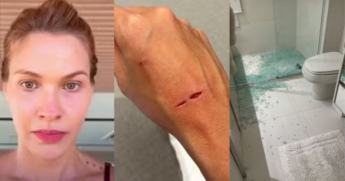 Andressa Suita sofre acidente no box, leva pontos após corte fundo nas ...