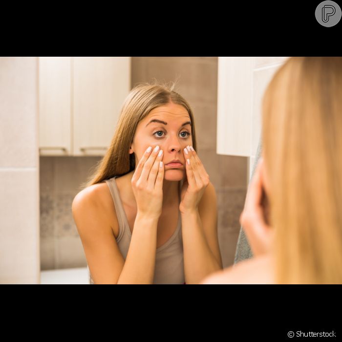 Saiba Qual Tipo De Olheira Você Tem E Qual Tratamento Recomendado