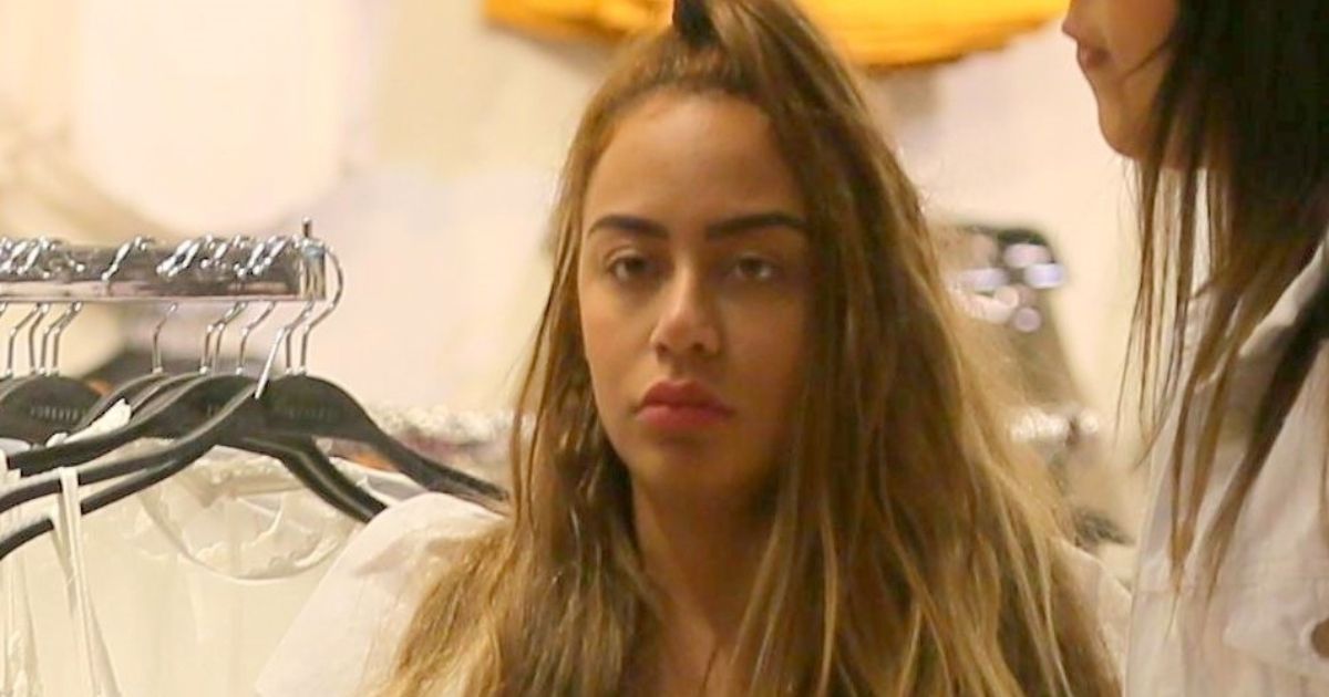 Rafaella Santos refez botox - Purepeople