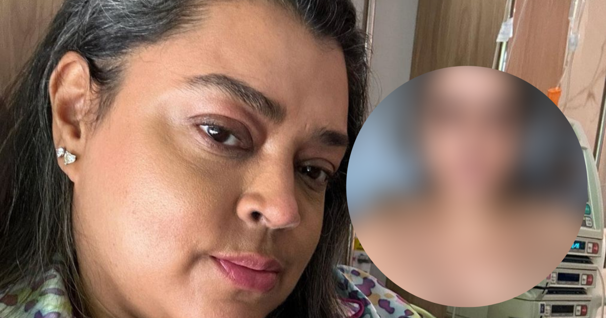 Em foto impactante, Preta Gil exibe cicatriz no seio e rosto sem ...