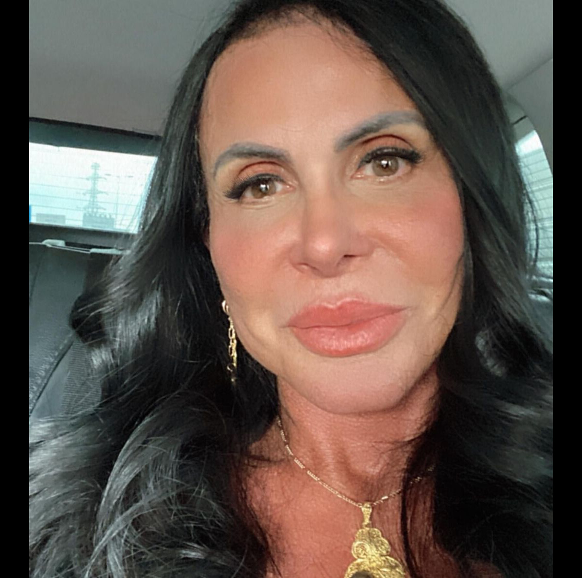 Foto: Gretchen tem 64 anos e já fez vários tratamentos estéticos ...