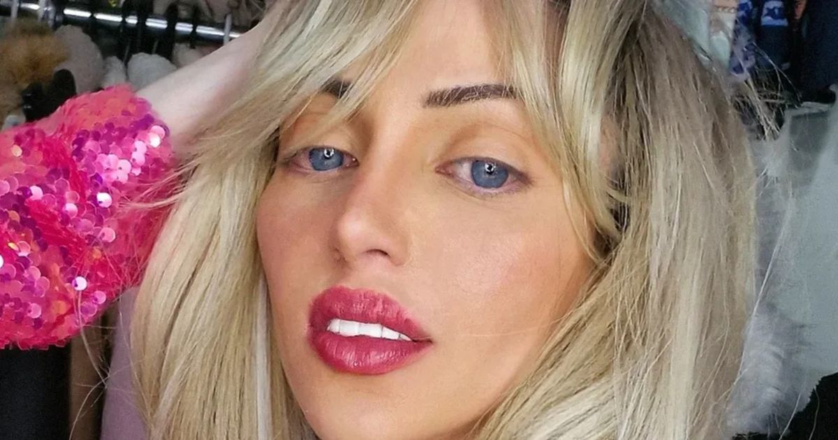 Qual foi a real causa da morte da Barbie Humana, ex de Dudu Camargo, de ...