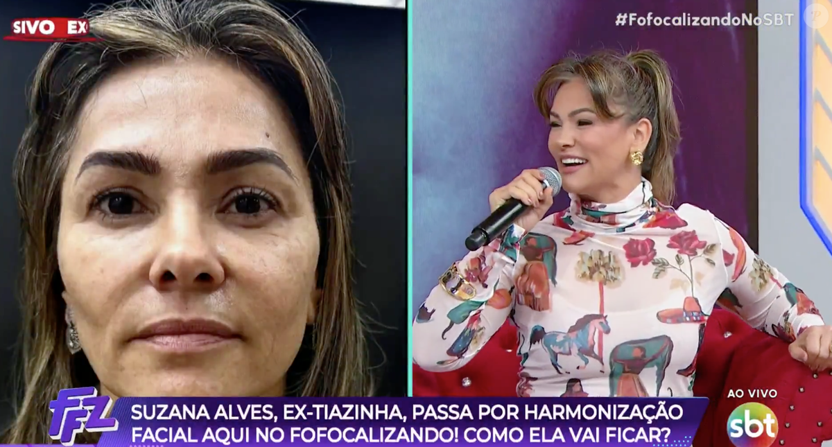 Foto: Suzana Alves impressionou pela transformação em seu rosto de ...