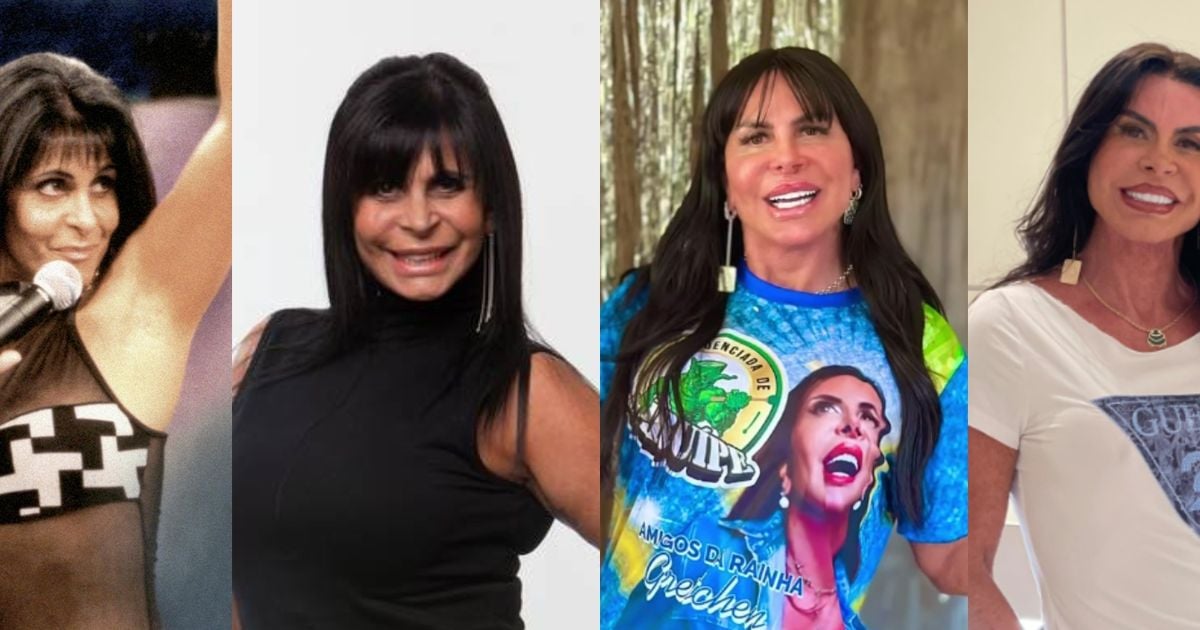 A mudança chocante de Gretchen: com 'novo rosto' aos 66 anos, cantora ...