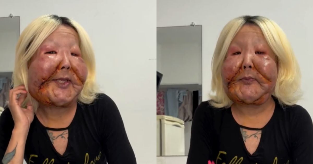 Como Juju do Pix ficou após a 2ª cirurgia no rosto? Influenciadora ...