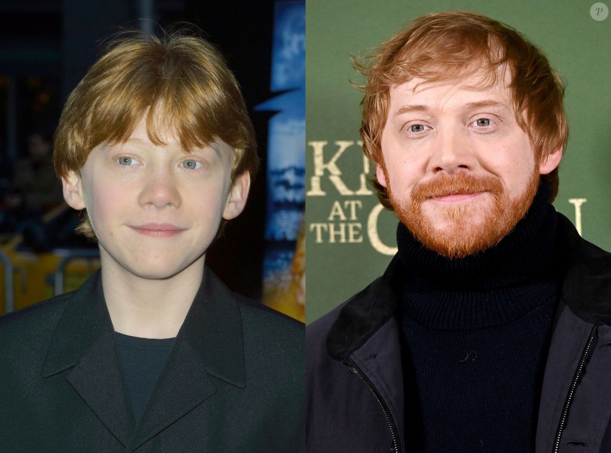 Foto: Antes e depois do ator Rupert Grint, de 'Harry Potter' - Purepeople