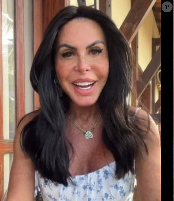 Antes e depois do 'novo rosto' de Gretchen viraliza e cantora rebate ...