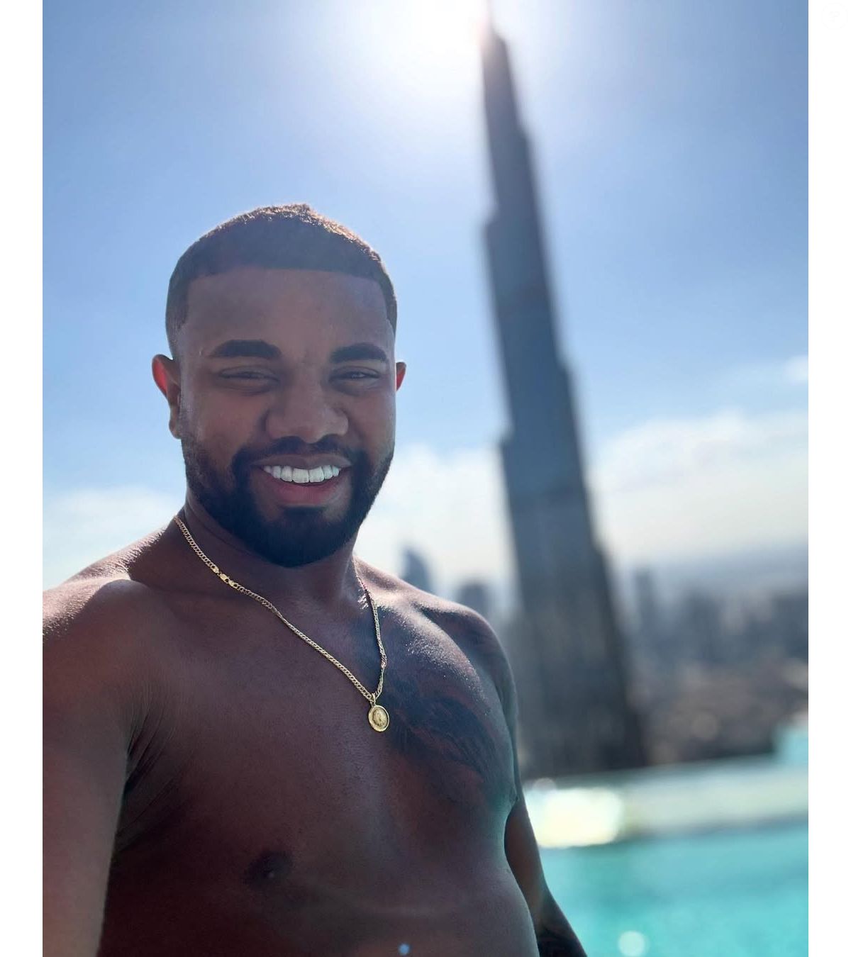 Foto: Neste sábado (26), Davi Brito revelou ter passado por uma ...