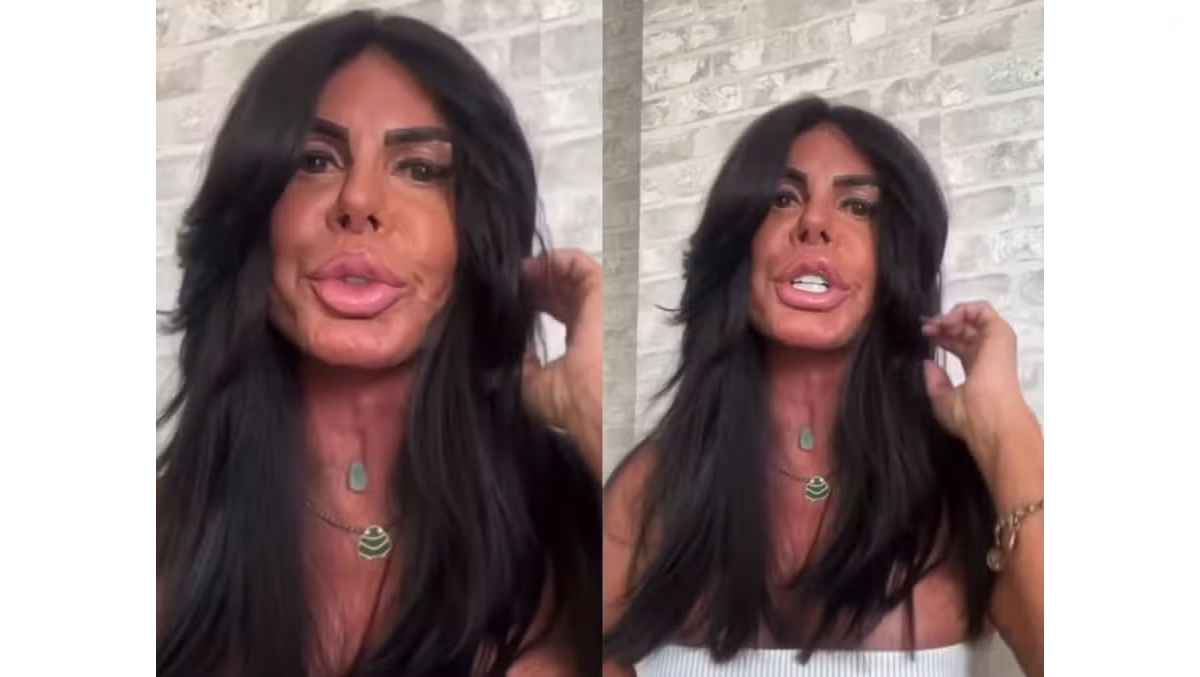 Foto: Gretchen passou recentemente por um novo procedimentos estéticos ...