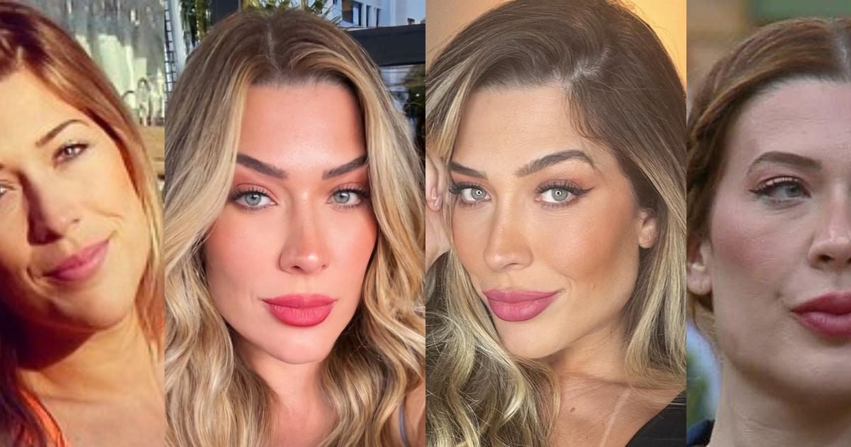 O que aconteceu com o rosto de Renata Muller? Em 'A Fazenda 17', ex de ...