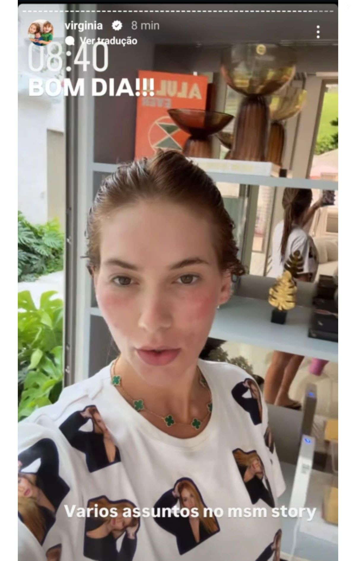 Foto: Nesta sexta-feira (27), Virgínia mostrou seu rosto menos inchado ...