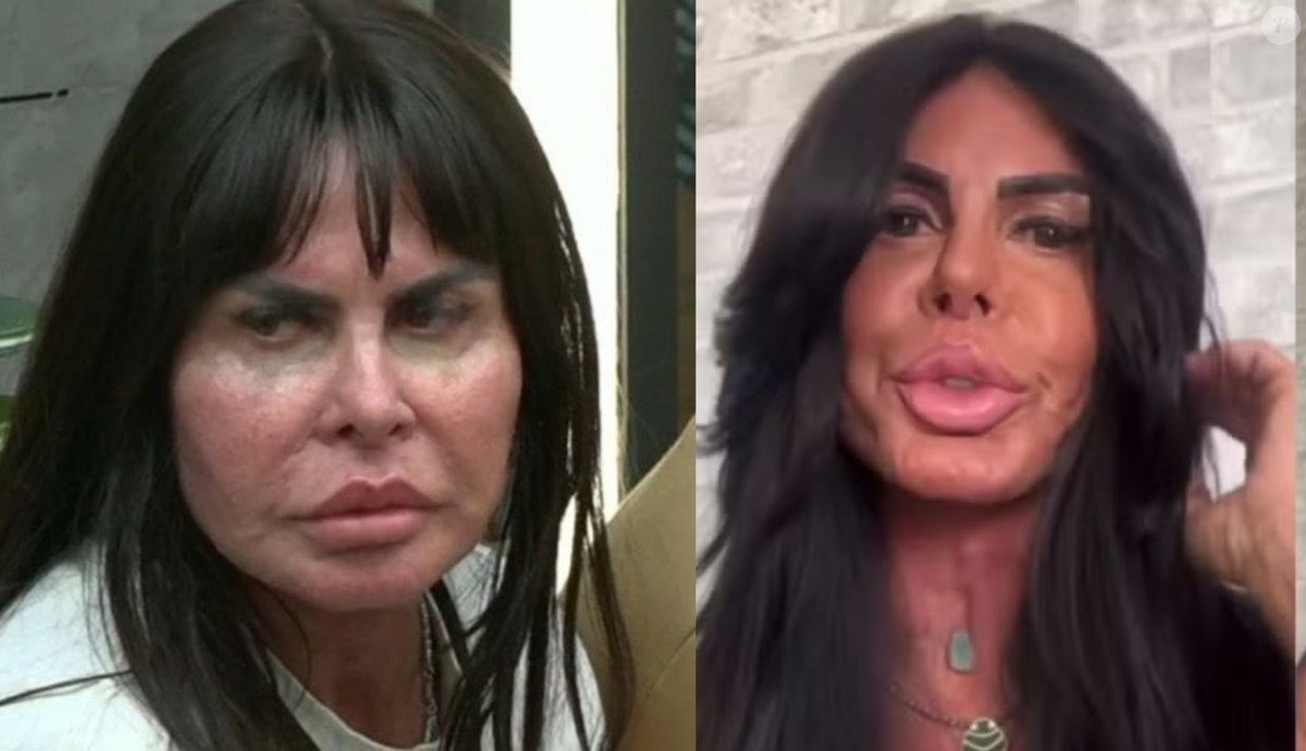 Foto: Antes e depois Gretchen: famosa exibe novo rosto após retirar ...