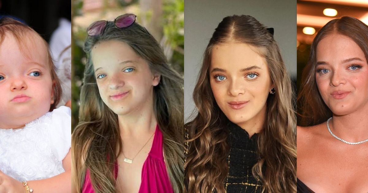 Antes e depois de Rafa Justus em 50 fotos: da infância à rinoplastia e ...