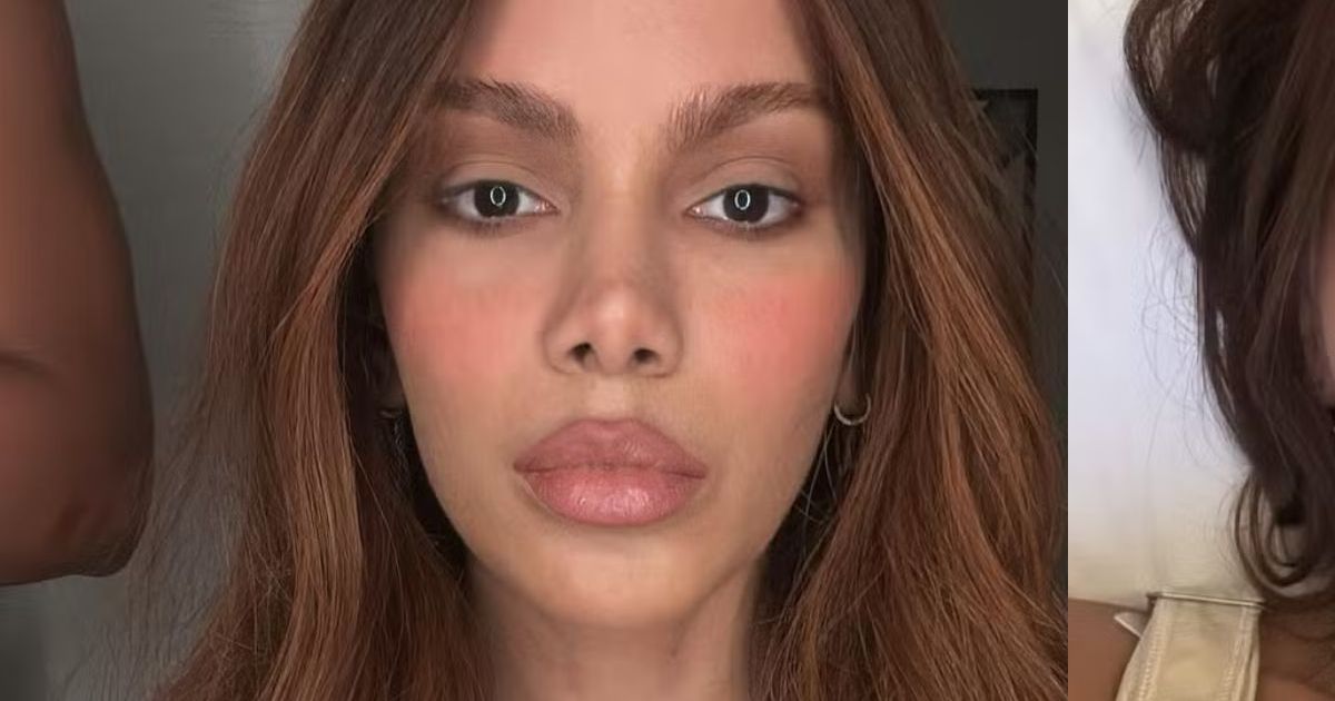 Exagerou? Após rosto 'irreconhecível' de Anitta viralizar, especialista ...