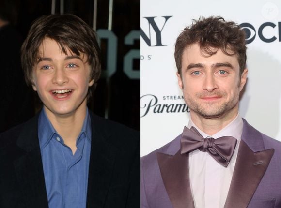 Foto: Antes e depois do ator Daniel Radcliffe, de 'Harry Potter ...