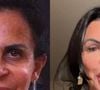 Famosas antes e depois do botox: essas 20 celebridades apostam no ...