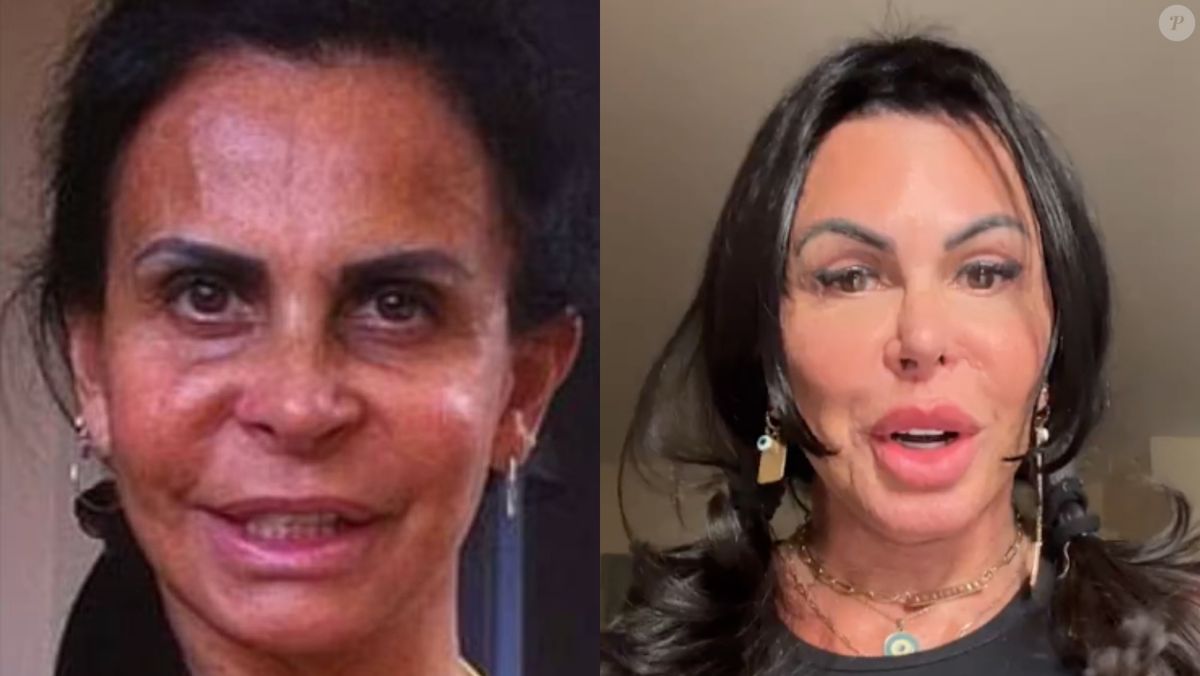 Foto: Gretchen aposta no botox e preenchimentos para manter seu olhar ...