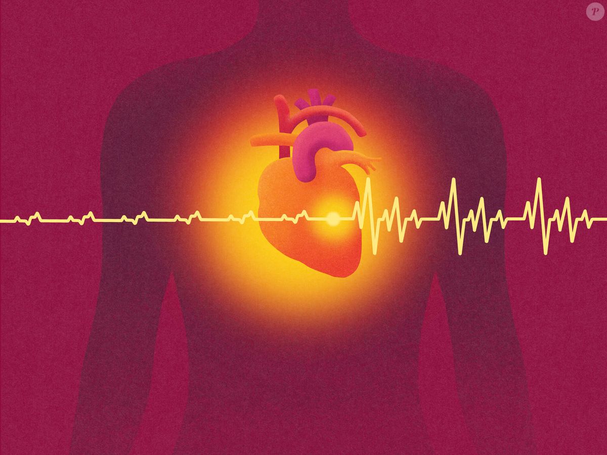Foto: ‘A fibrilação atrial, como o próprio nome diz, representa uma ...