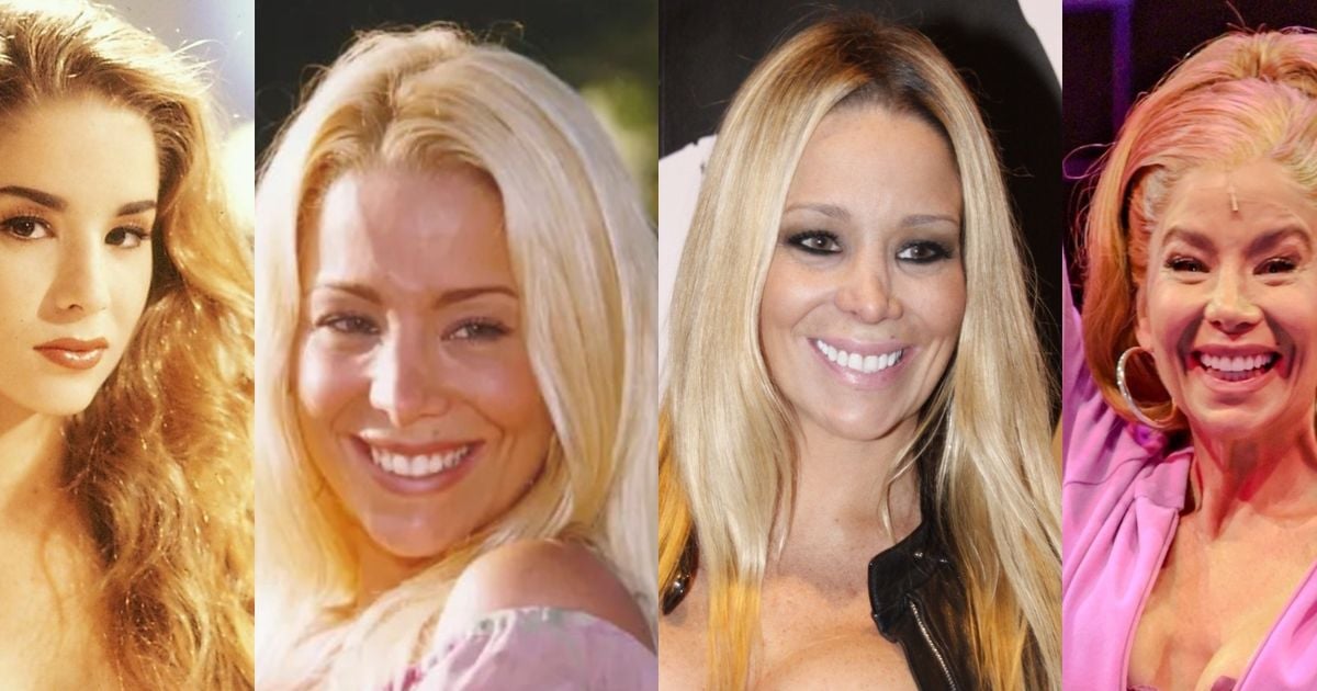 Antes e depois de Danielle Winits: atriz mudou aparência com plástica e ...