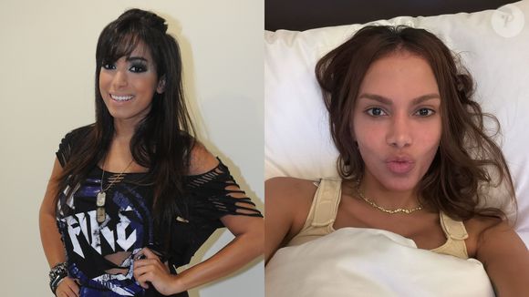 Antes e depois de Anitta, Virgínia Fonseca e mais: estes 22 famosos ...