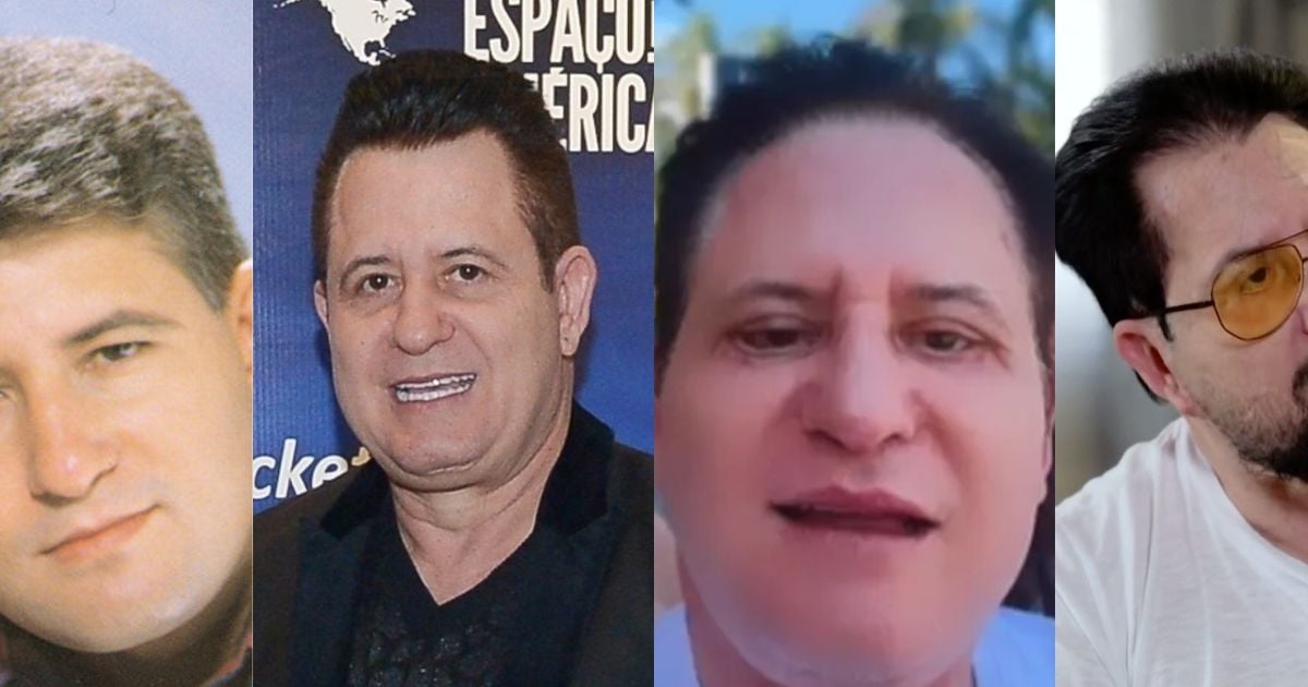 Antes e depois de Marrone: de harmonização facial ao acidente recente ...