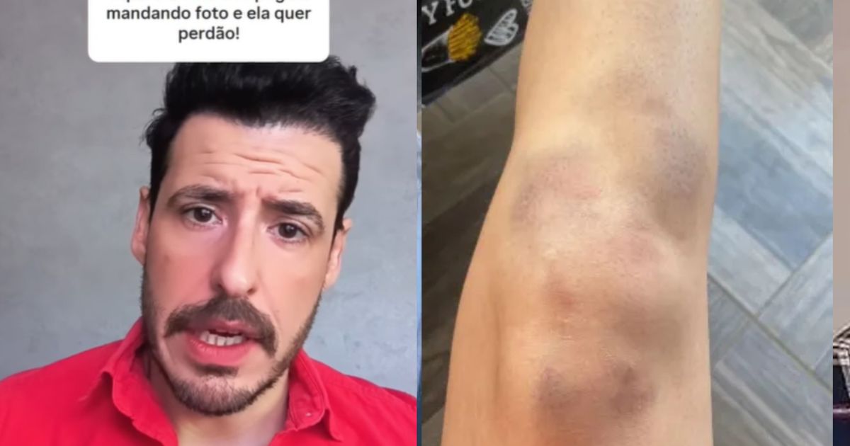 Caso Calvo do Campari: Thiago Schutz sai da prisão após denúncia de agressão contra a namorada ...