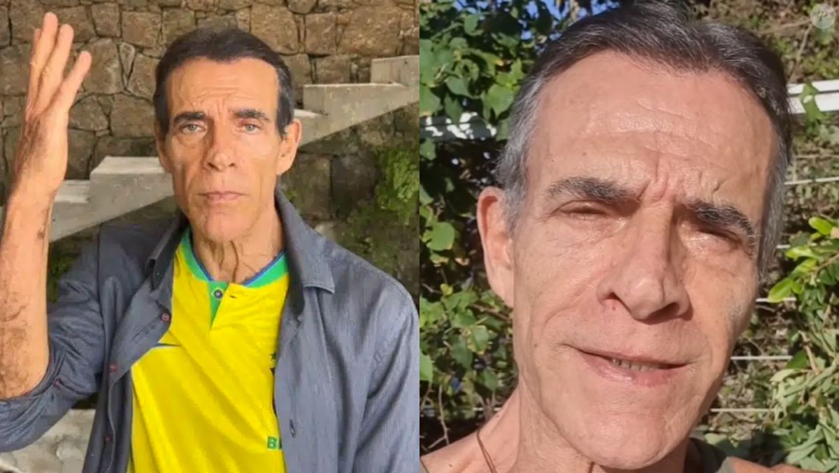 Foto: Mário Gomes antes e depois: ator faz harmonização facial aos 72 ...