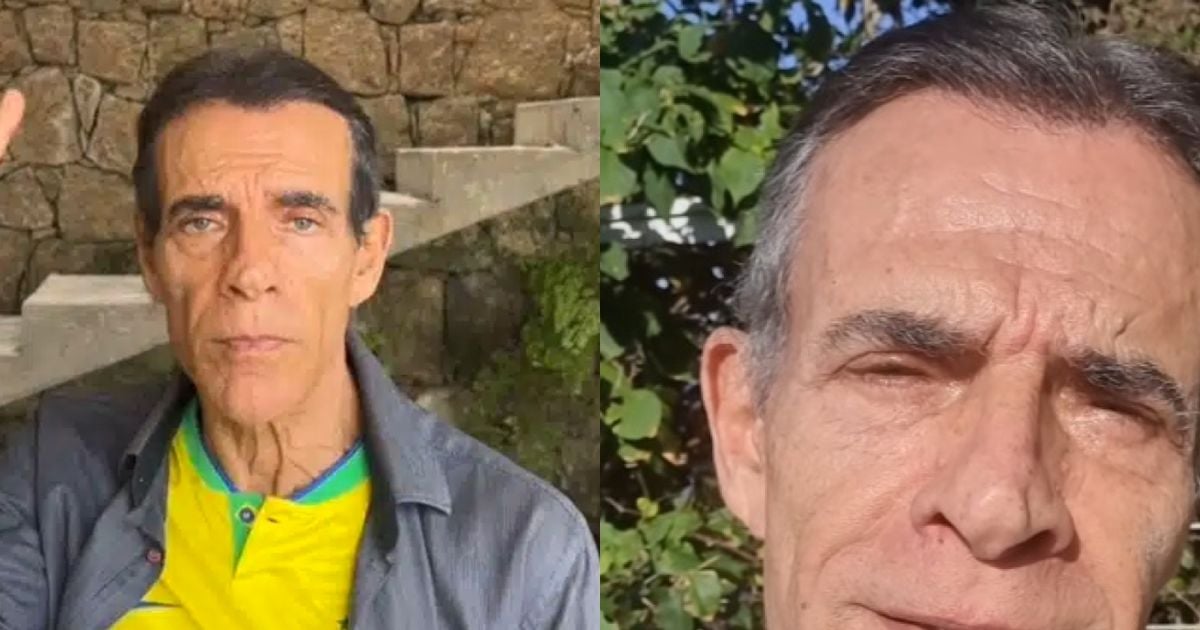 Antes e depois de Mário Gomes: ator de 'A Favorita' faz harmonização ...