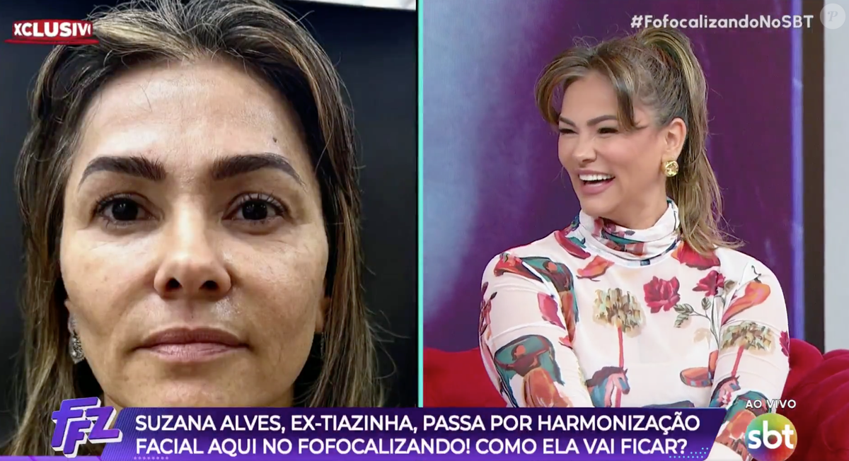Foto: 'Novo rosto' de Suzana Alves viralizou na internet e rendeu ...