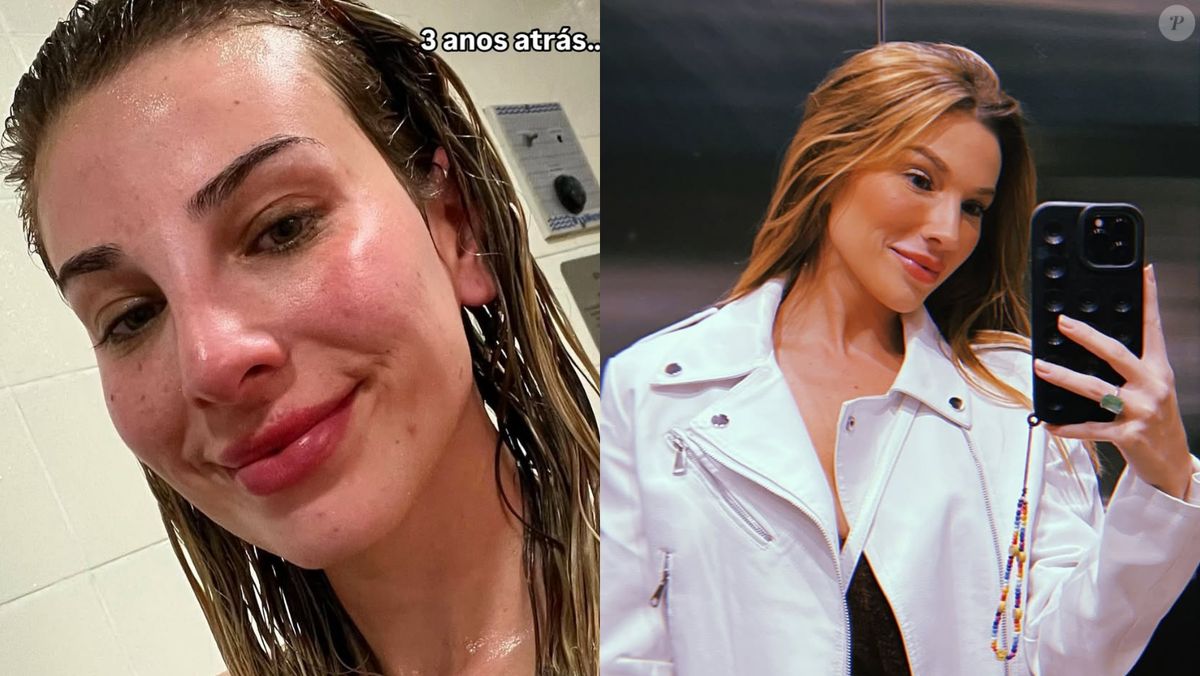 Foto: Antes e depois de Maria Caporusso: ex-participante do 'Casamento ...