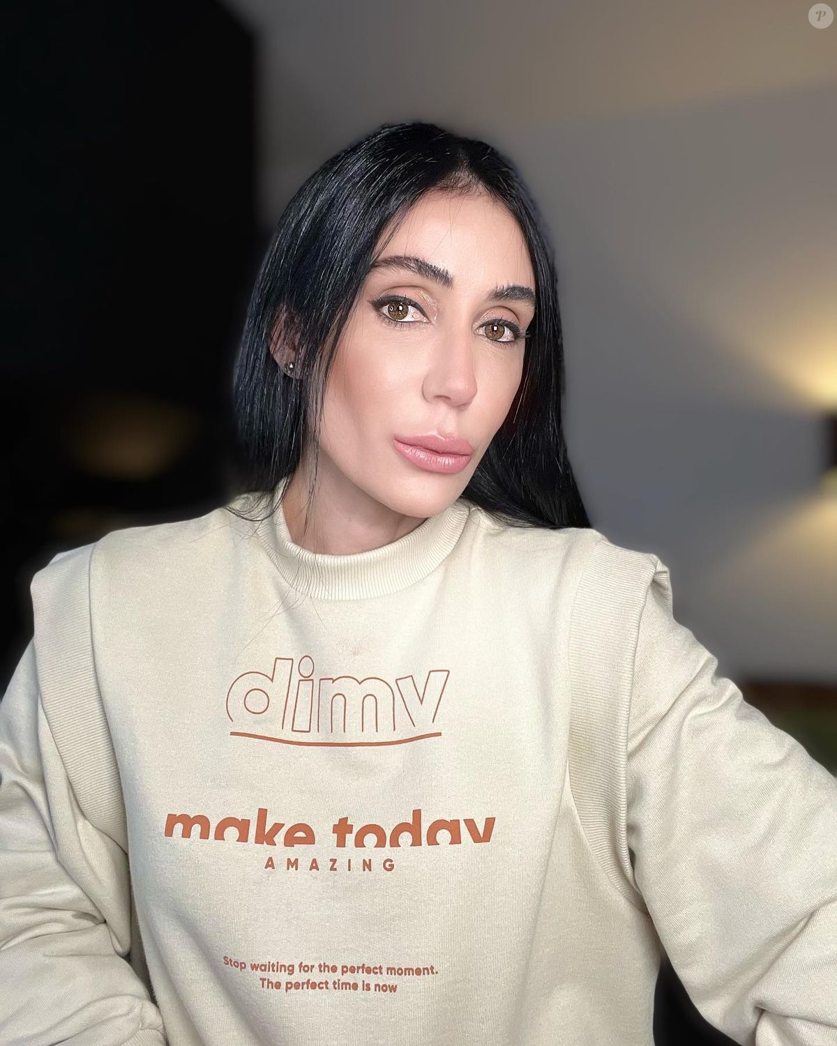 Foto: Outra mudança impactante de Michelle Barros foi em seus lábios ...