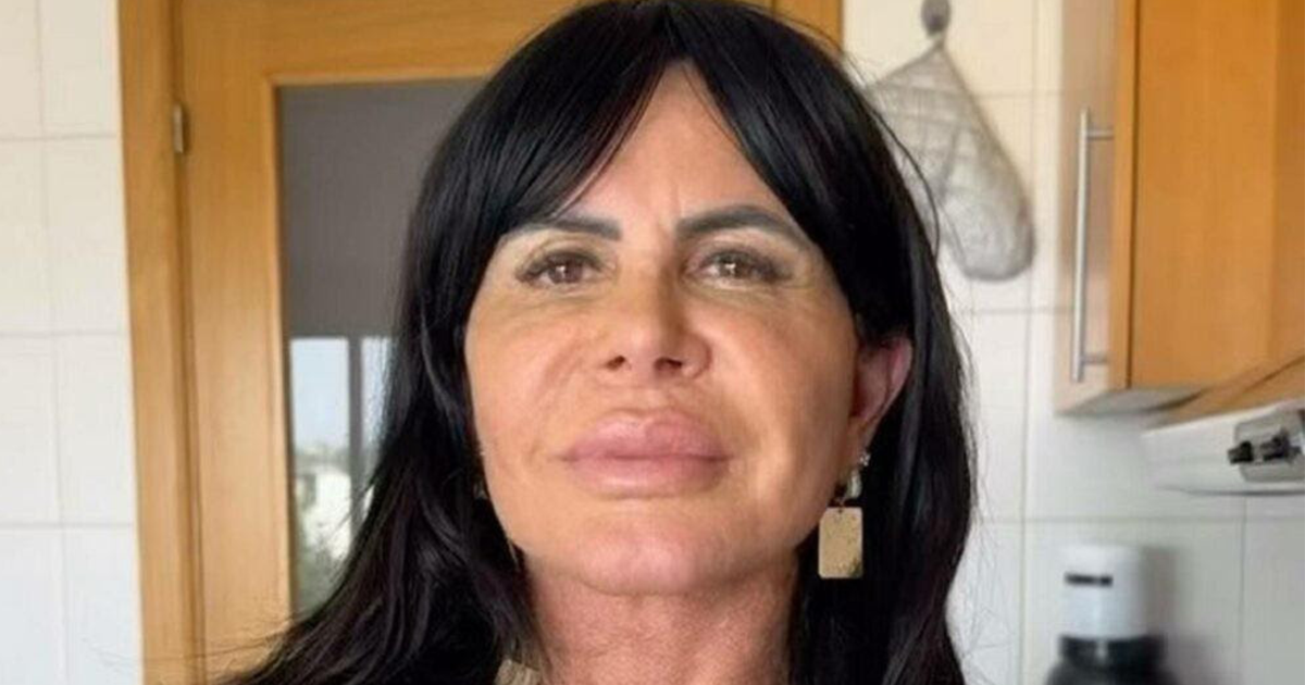 Gretchen estreia 'novo rosto' após procedimentos, é comparada com ...