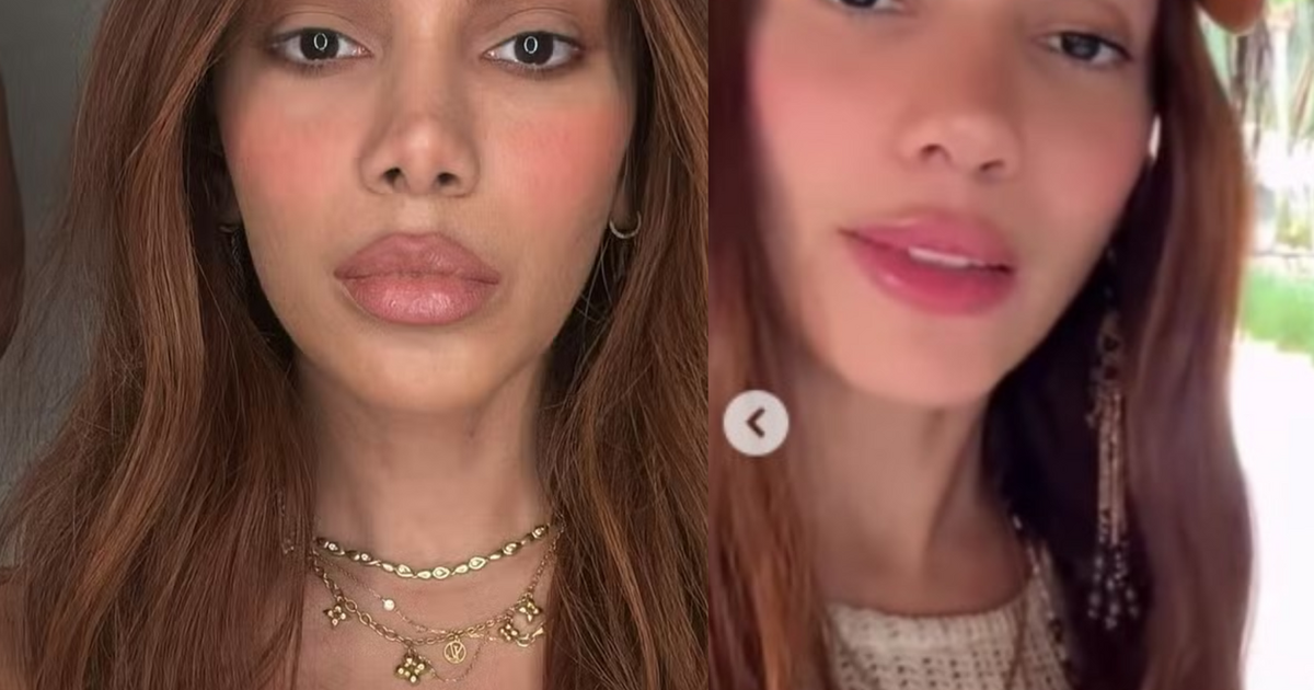 Anitta mexeu no nariz, de novo? Web aponta nova rinoplastia e mudança ...