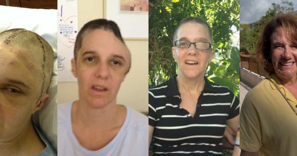 Antes e depois de Renee Murdoch: veja em 32 fotos como está hoje a ...