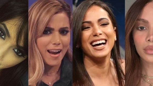 Por que Anitta fez tantas plásticas? Um detalhe específico mudou TUDO ...